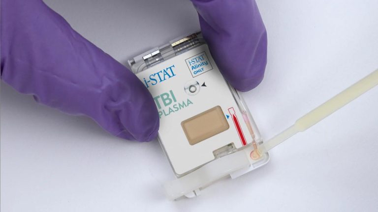 Rapid Blood Test Can Diagnose Brain Injury on Sports Field Sidelines ...