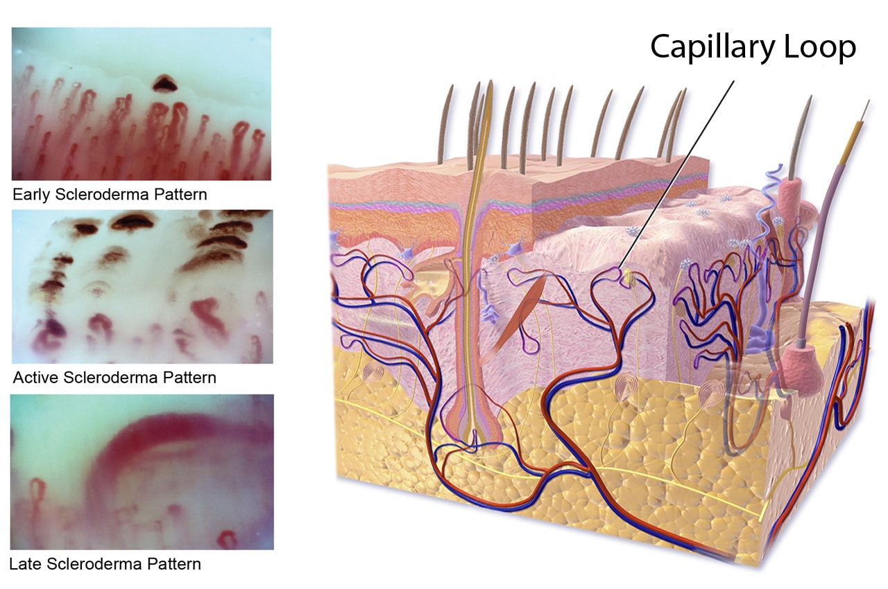 Inspectis Expand Possibilities of Capillaroscopy Examination ...