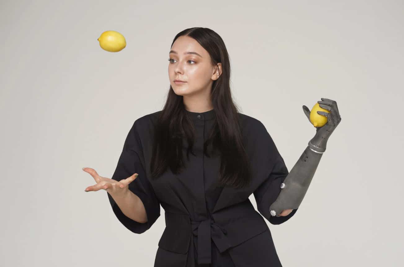 The Body Is Not a Limit With the Esper Hand Prosthetic Arm ...