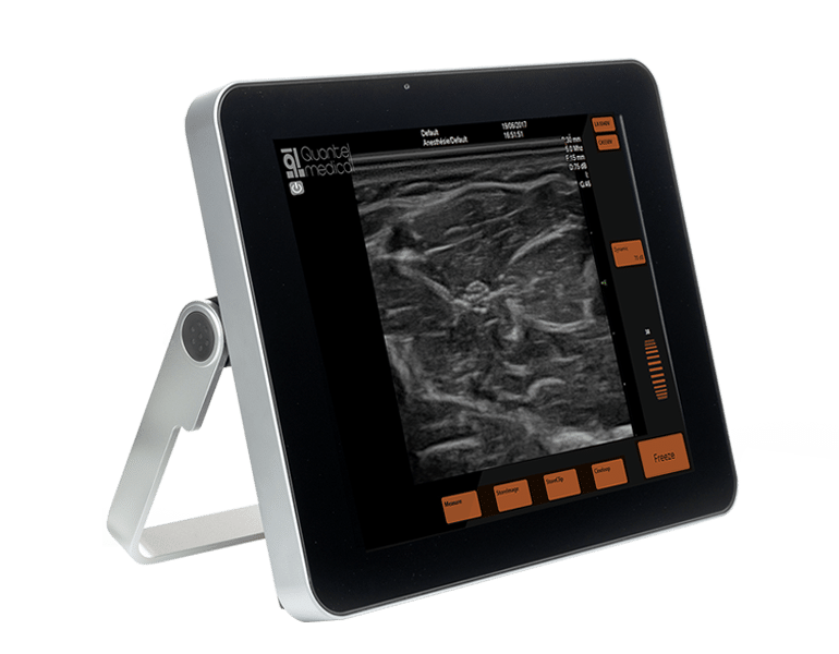 Quantel’s Evotouch: More Precision for Anesthesiologists - MedicalExpo ...