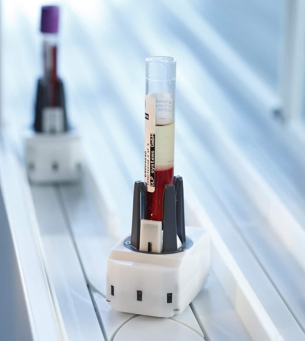 Automation in Medical Laboratory Diagnostics: Smooth Sailing Through ...