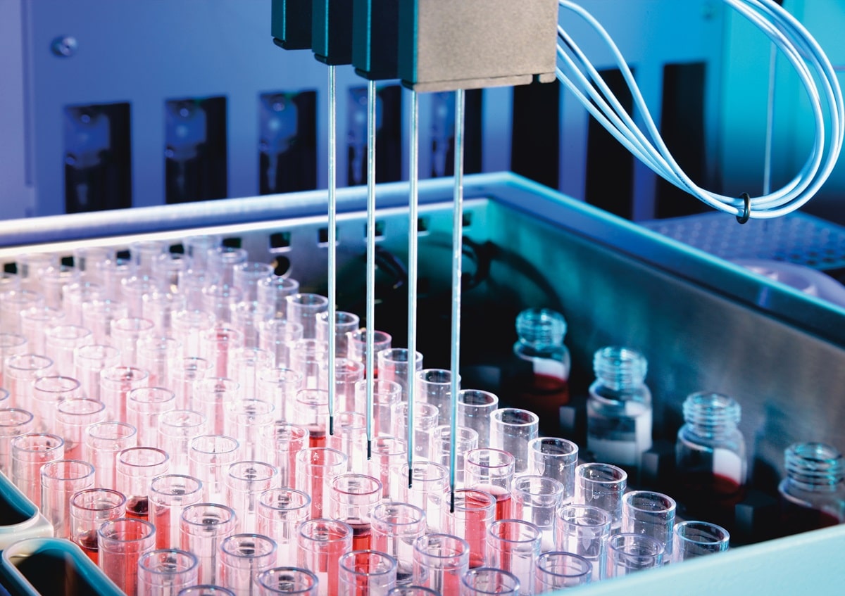 Automation in Medical Laboratory Diagnostics: Smooth Sailing Through ...