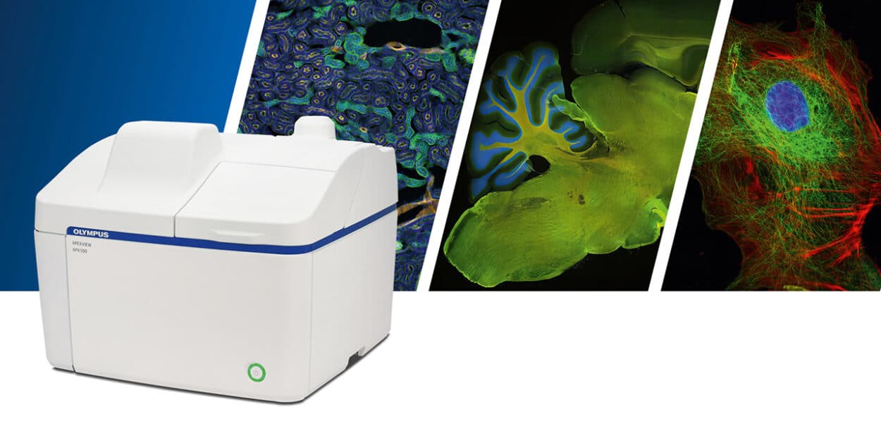 SPONSORED. Microscopy Simplified With All-In-One Imaging - MedicalExpo ...