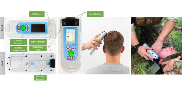 MEDICA 2023: Cutting-Edge Technologies for Digital Diagnostics - MedicalExpo e-Magazine