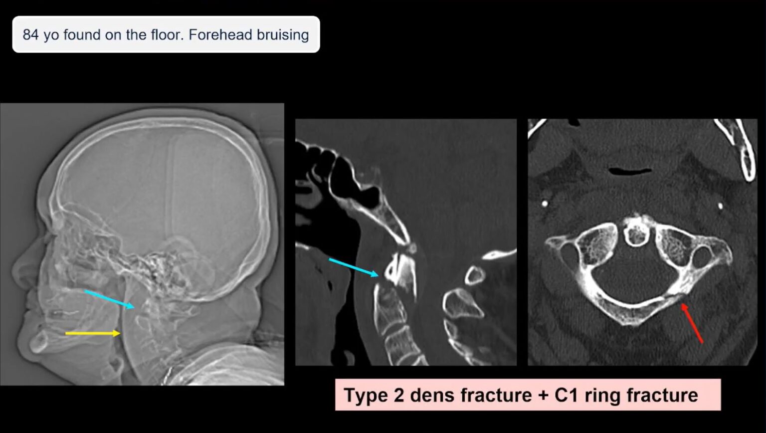 Whole-body Imaging Critical for Elderly Trauma - MedicalExpo e-Magazine