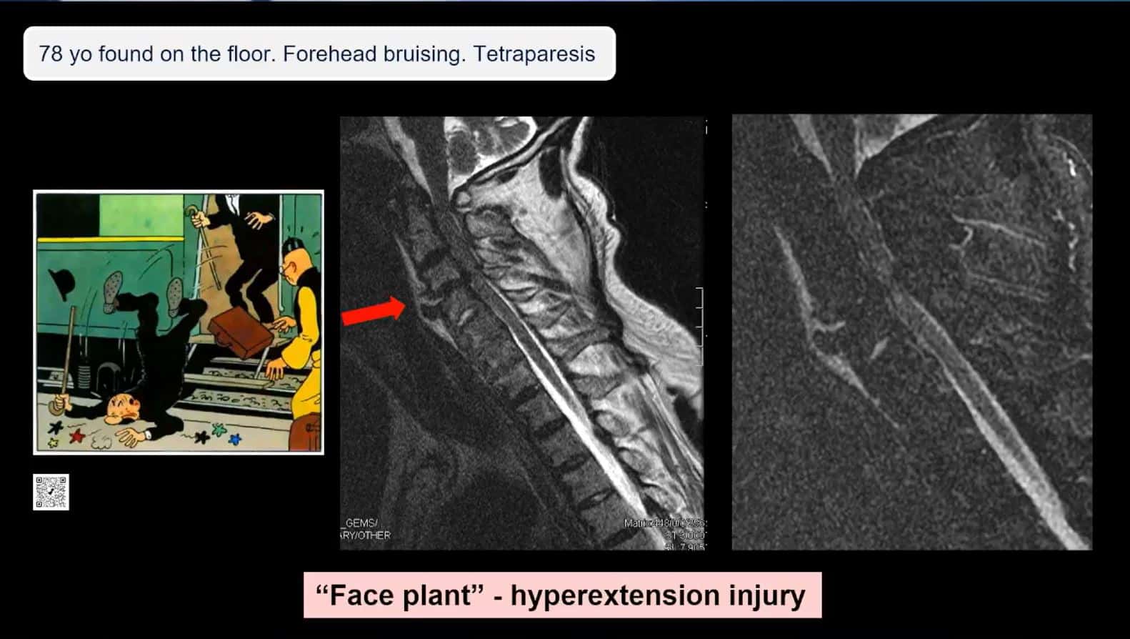 Whole-body Imaging Critical for Elderly Trauma - MedicalExpo e-Magazine