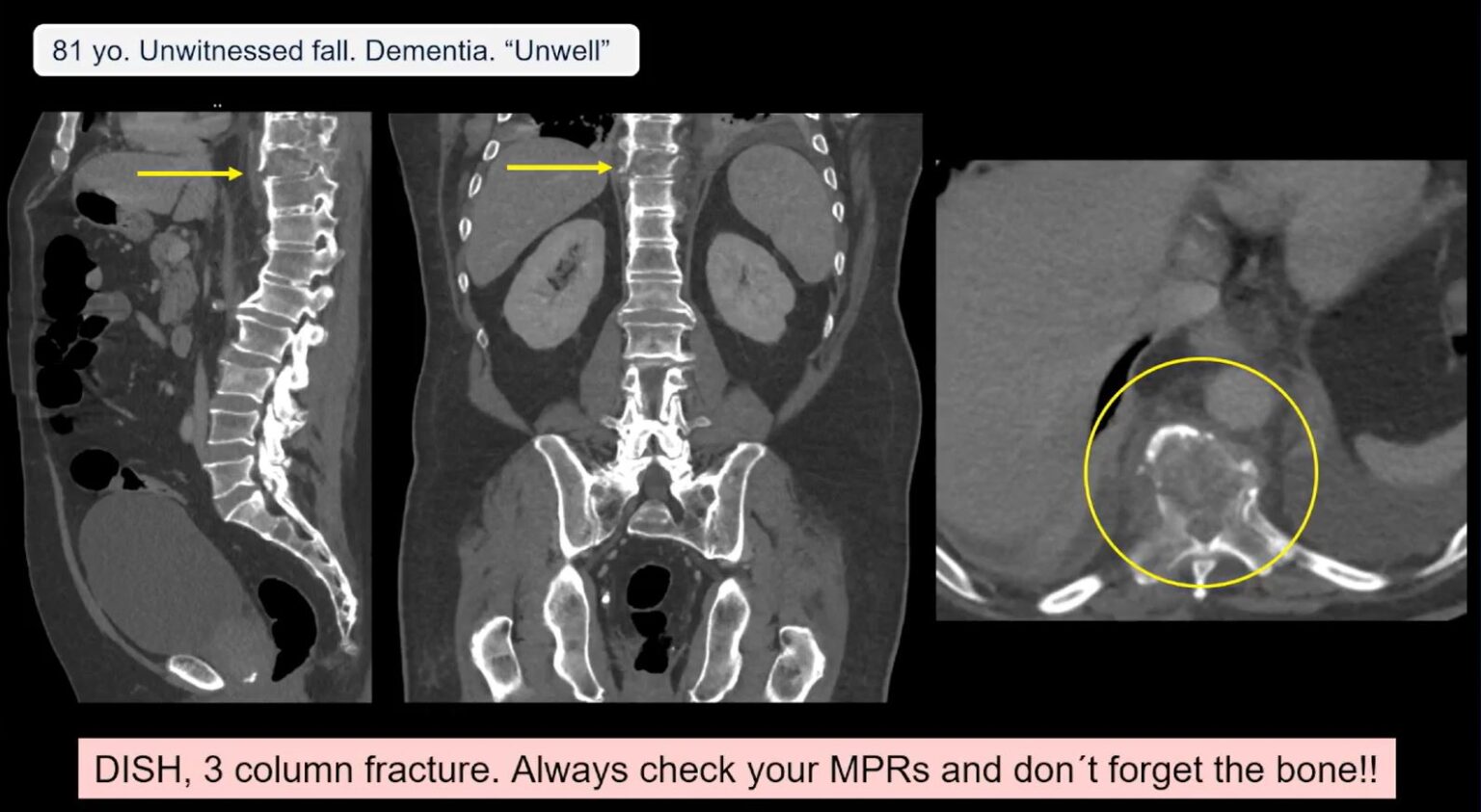 Whole-body Imaging Critical for Elderly Trauma - MedicalExpo e-Magazine