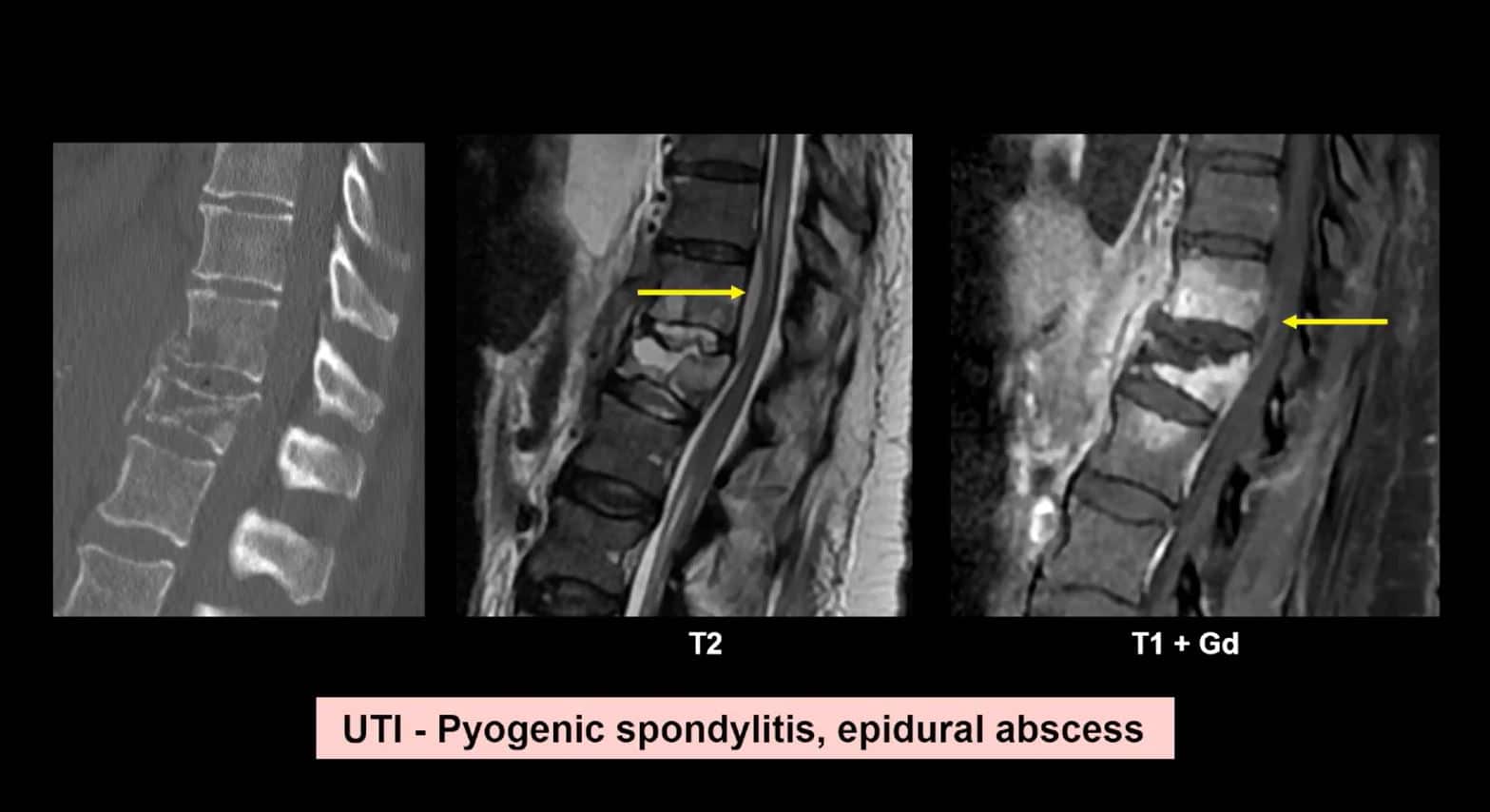 Whole-body Imaging Critical for Elderly Trauma - MedicalExpo e-Magazine