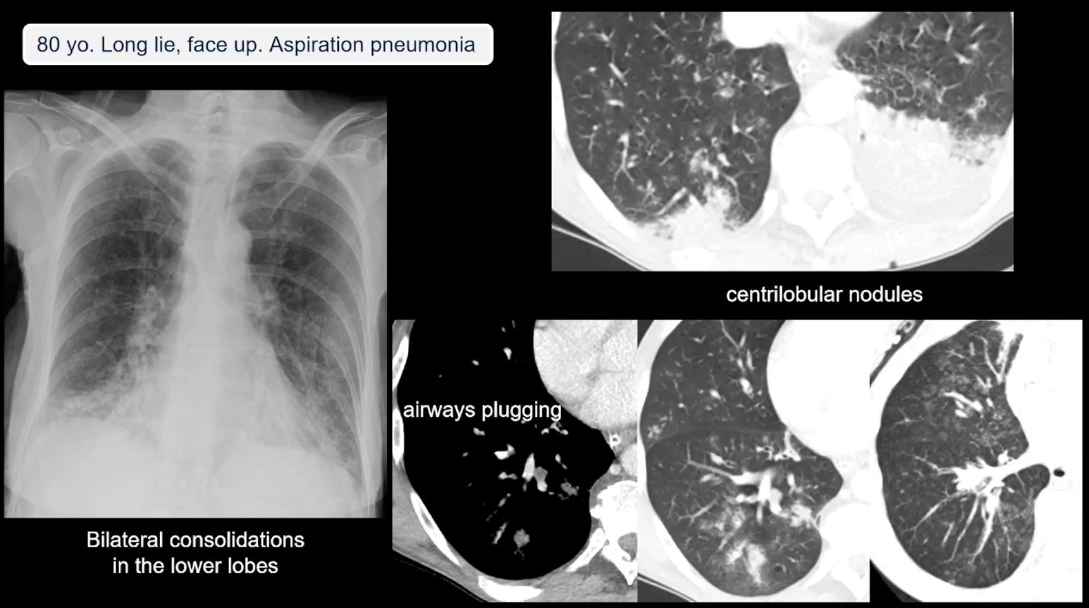 Whole-body Imaging Critical for Elderly Trauma - MedicalExpo e-Magazine