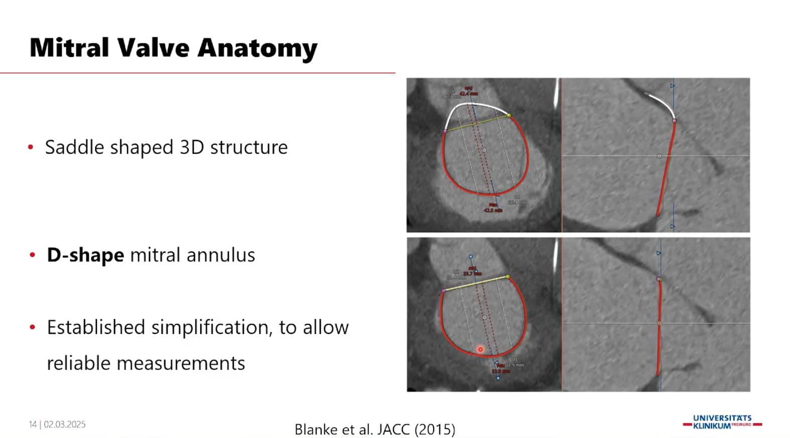 Measuring the Heart: A Radiologist with a Ruler - MedicalExpo e-Magazine
