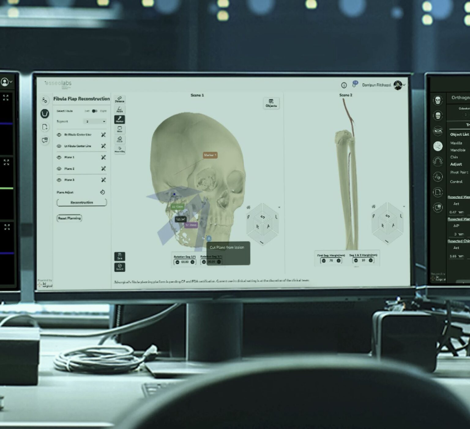Can AI Make Surgery Safer for Everyone? - MedicalExpo e-Magazine