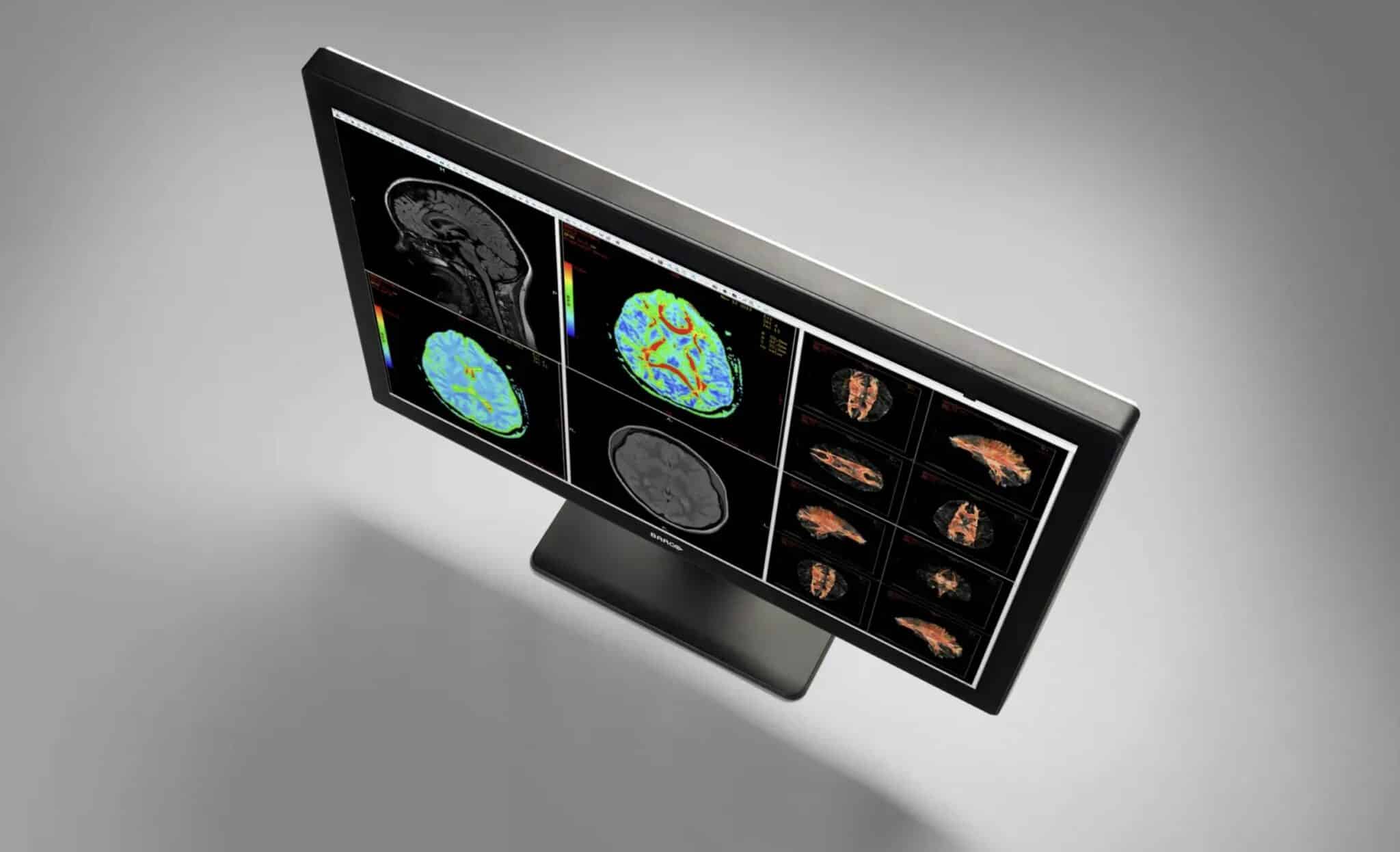 vRad Optimizes Remote Radiology with Barco Equipment - MedicalExpo e ...