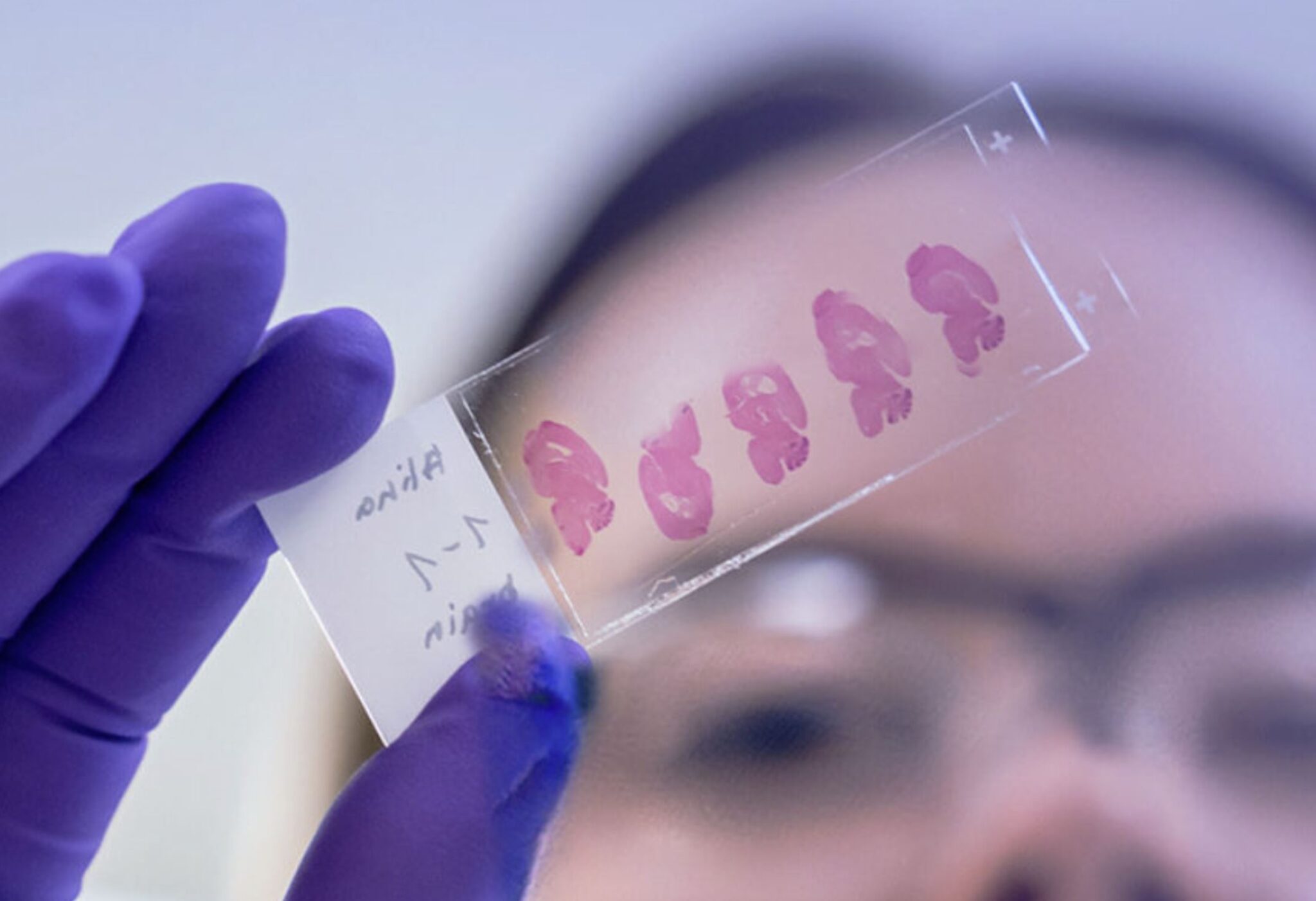 Understanding AI in Drug Discovery with Evotec - MedicalExpo e-Magazine