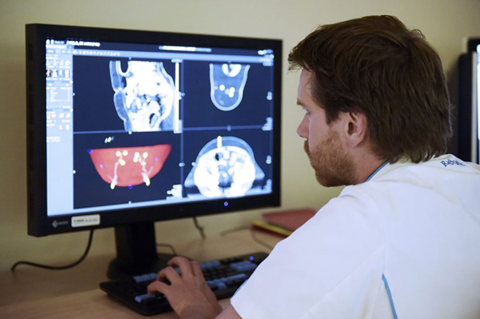 The Anatomy Projector: Giving Surgeons Supervision with AR ...