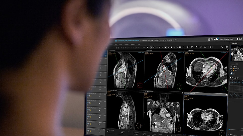 New Imaging Systems: Rembra CT Platform by Philips - MedicalExpo e-Magazine