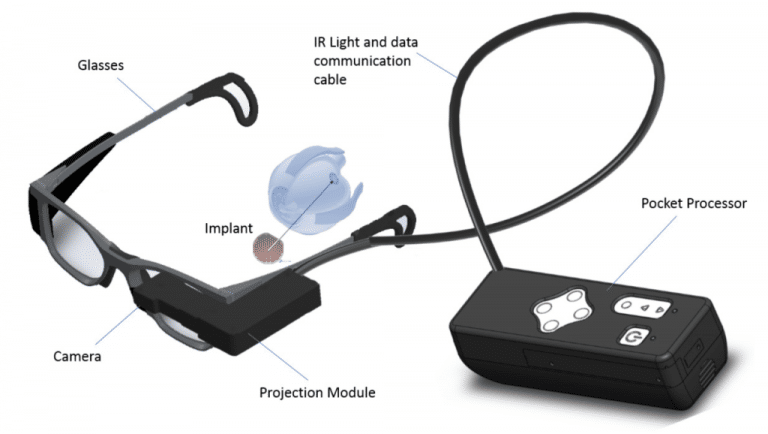 The Prima Implant Gives Hope of Sight Restoration to the Partially ...